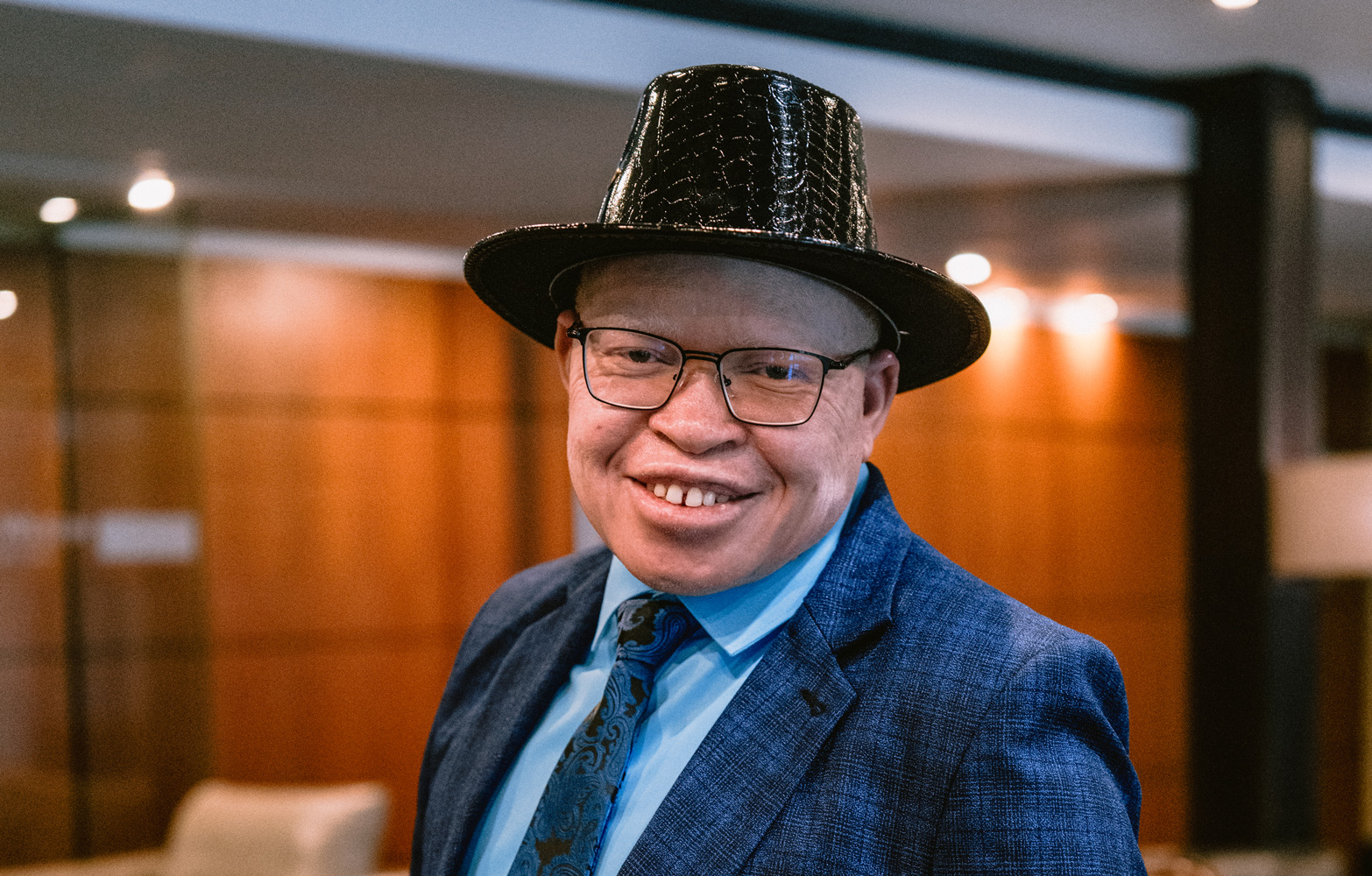 Peter Ogik’s Journey: Overcoming Stigma and Advocating for People with Albi