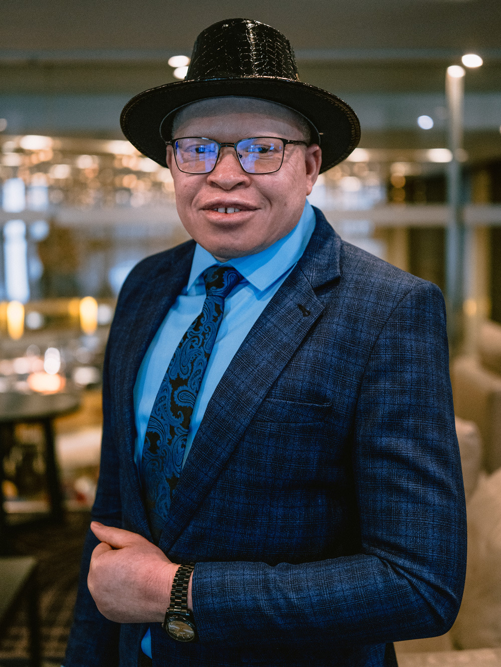 Peter Ogik’s Journey: Overcoming Stigma and Advocating for People with Albi