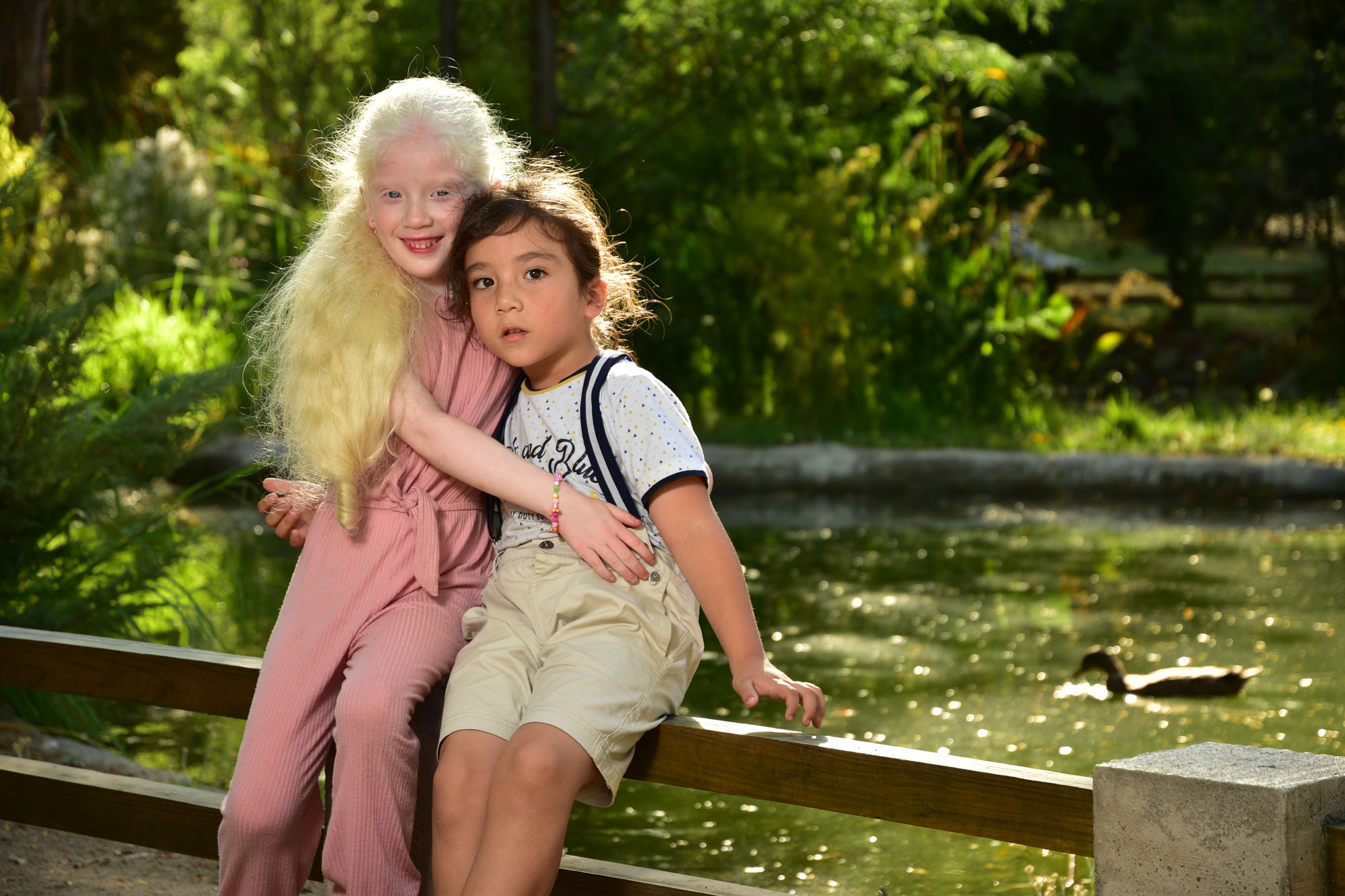 Global Albinism Alliance Congratulates Albinos Chile on Progress Toward Sun